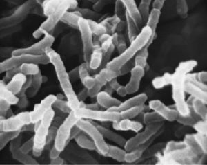 Malolactic Fermentation - WineMakerMag.com